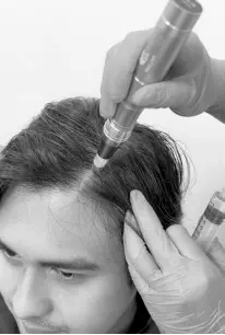 Nexohair is next-level hair and scalp interventi­on using exosomes - PressReader