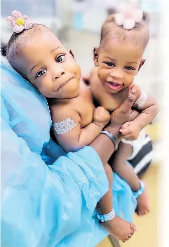 Conjoined twins due for separation in September - PressReader