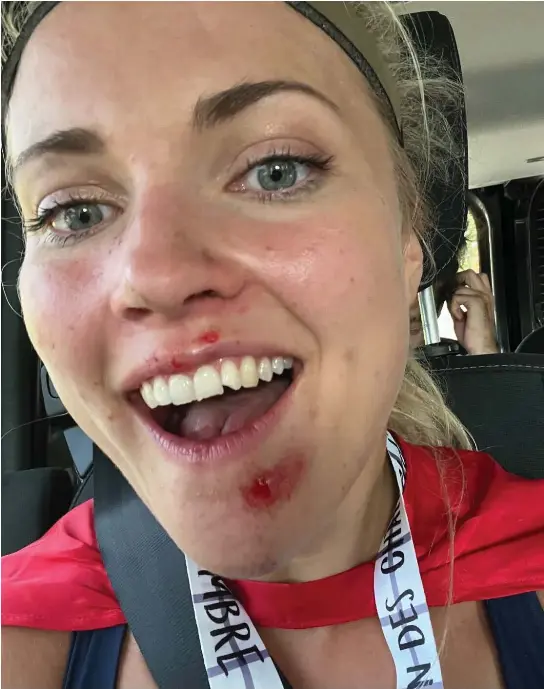 SKADET UNDER MARA-TANN - PressReader