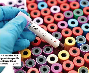 Prostate cancer test guidelines ‘unclear’ - PressReader