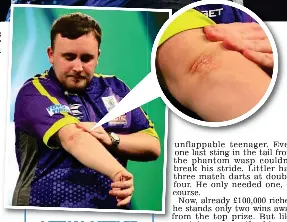 Not even the Ally Pally wasp can stop buzzing Littler! - PressReader