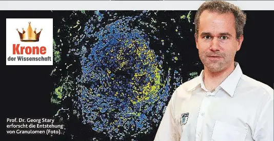 Granulomen auf der Spur - PressReader