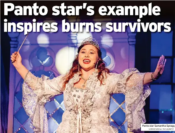 Panto star’s example inspires burns survivors - PressReader