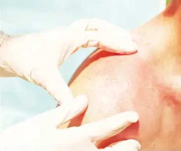 How rash to dermatolog­ists to fast, get according rid of heat ...